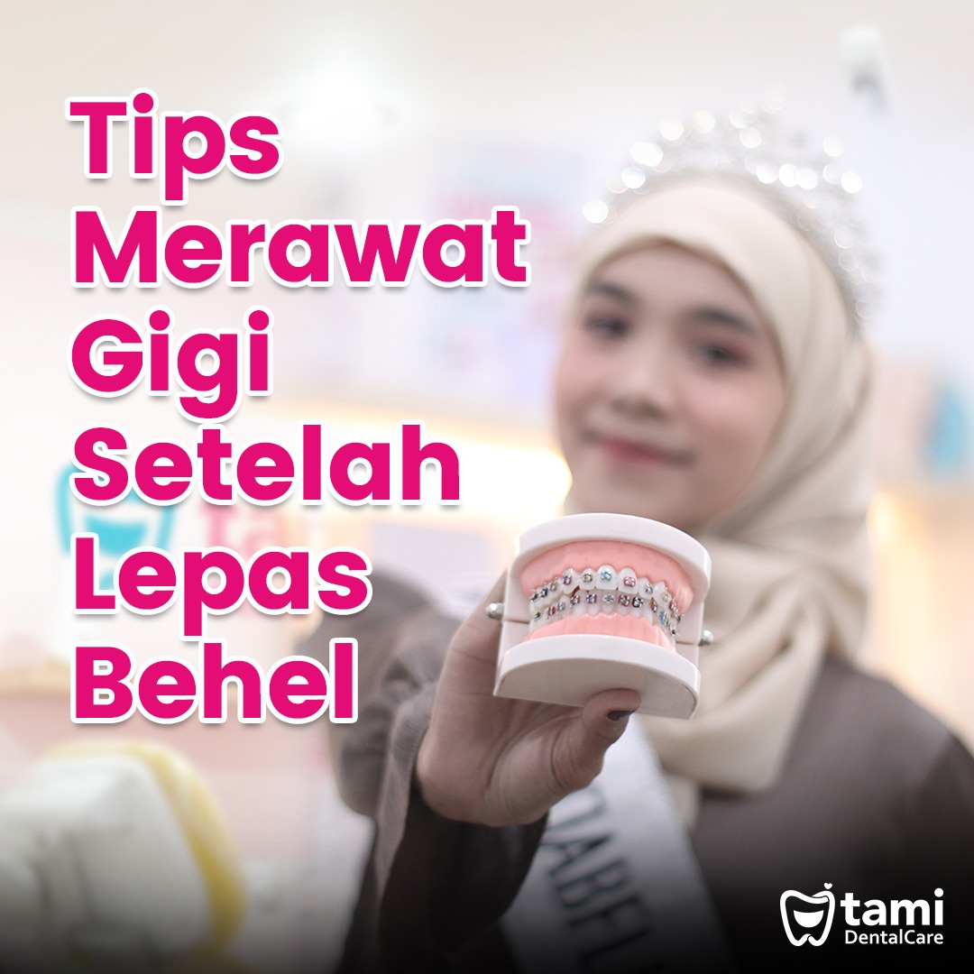 Tips Merawat Gigi Setelah – Tami Dental Care – Klinik Gigi Dokter Gigi ...